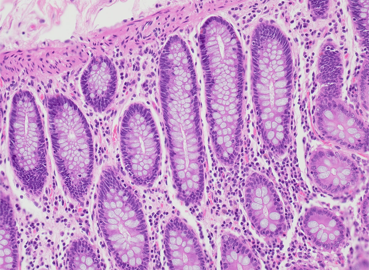 Microscope Digital Camera DP75 – PT Wadya Prima Mulia